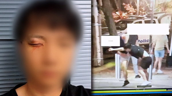 [단독] "XX 타일랜드" "스몰 아이즈"…호주 집단폭행 ‘악몽’